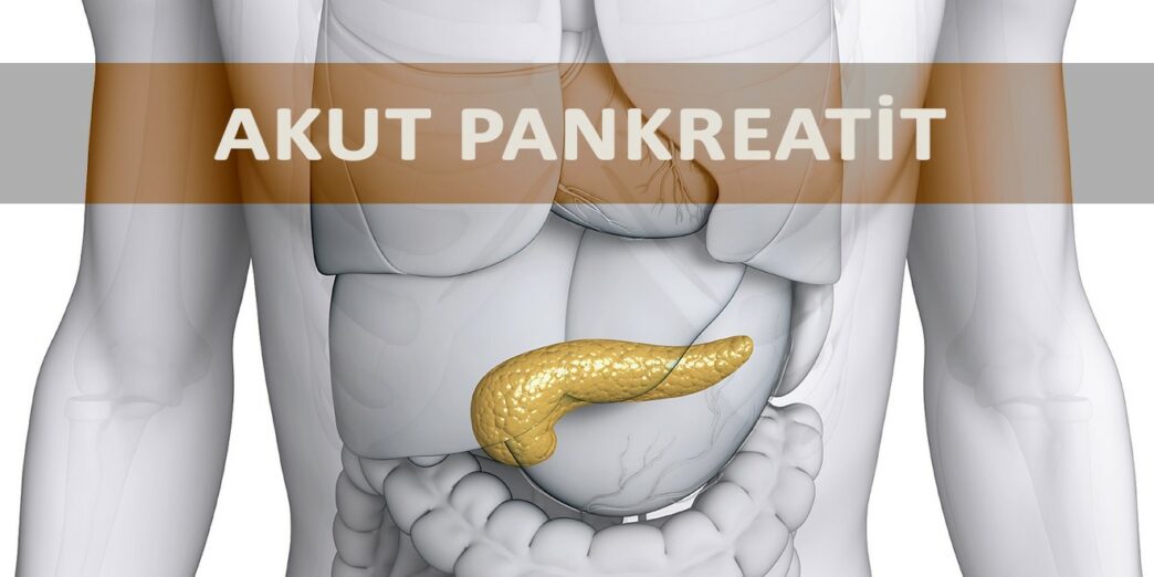 Akut Pankreatit - Acilci.Net