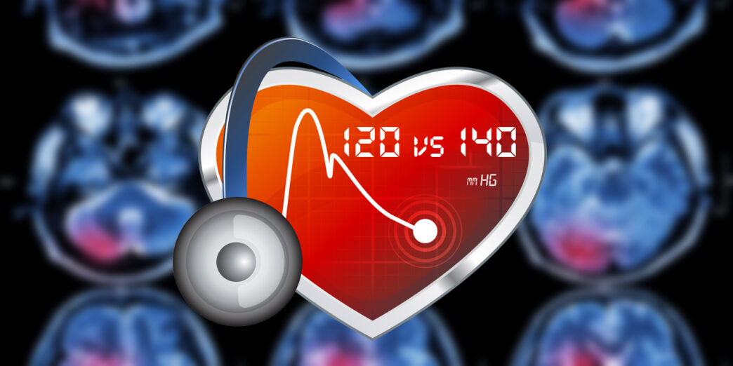 ATACH-II vs INTERACT2: İntrakraniyal kanamada sistolik tansiyon hedefi ...