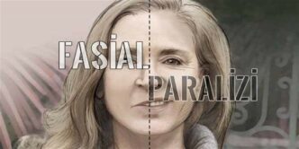 Acil Serviste Periferik Fasiyal Paralizi Yönetimi - Acilci.Net