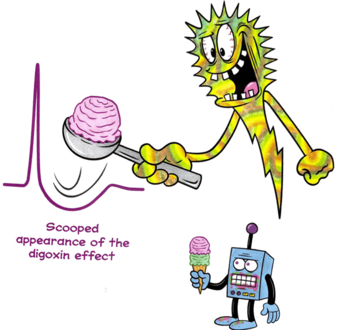Sparkson’un Resimli EKG Kitabı – Yorumlama Kılavuzu - Acilci.Net