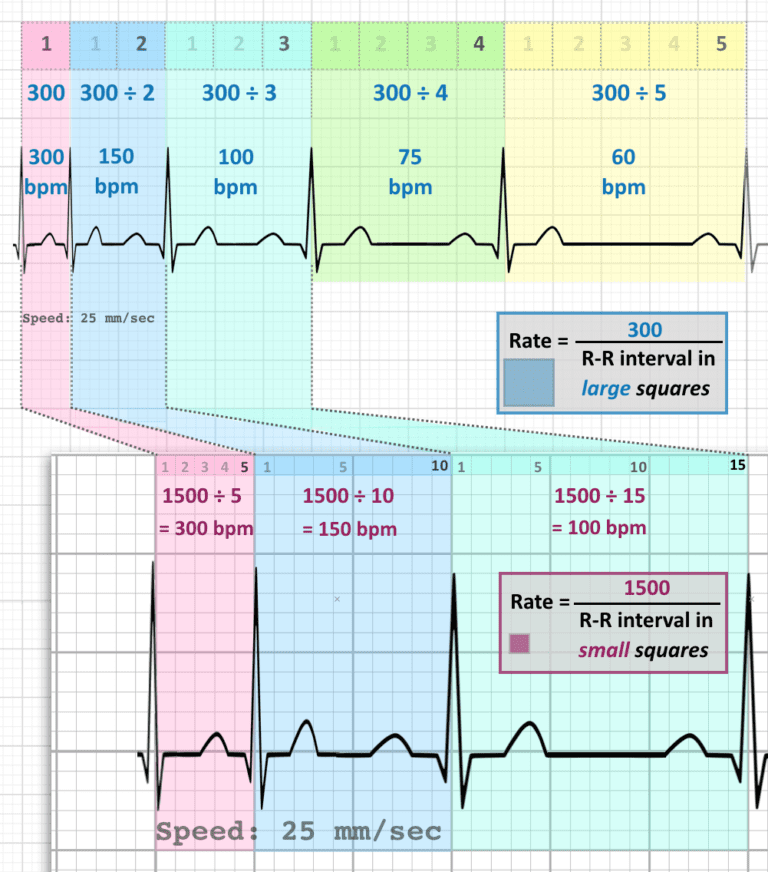 EKG H z Yorumlama Acilci Net
