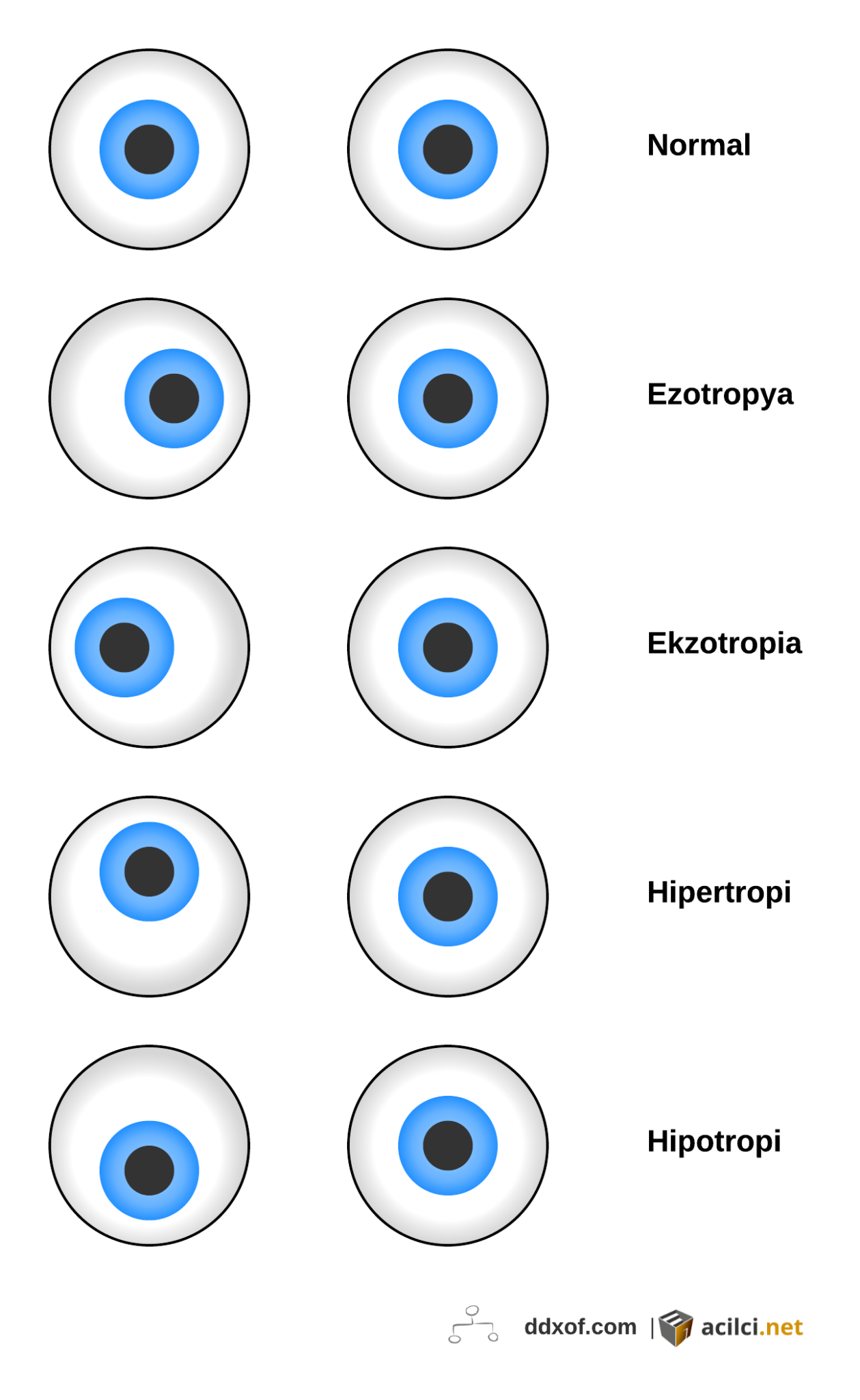 Diplopi - Acilci.Net