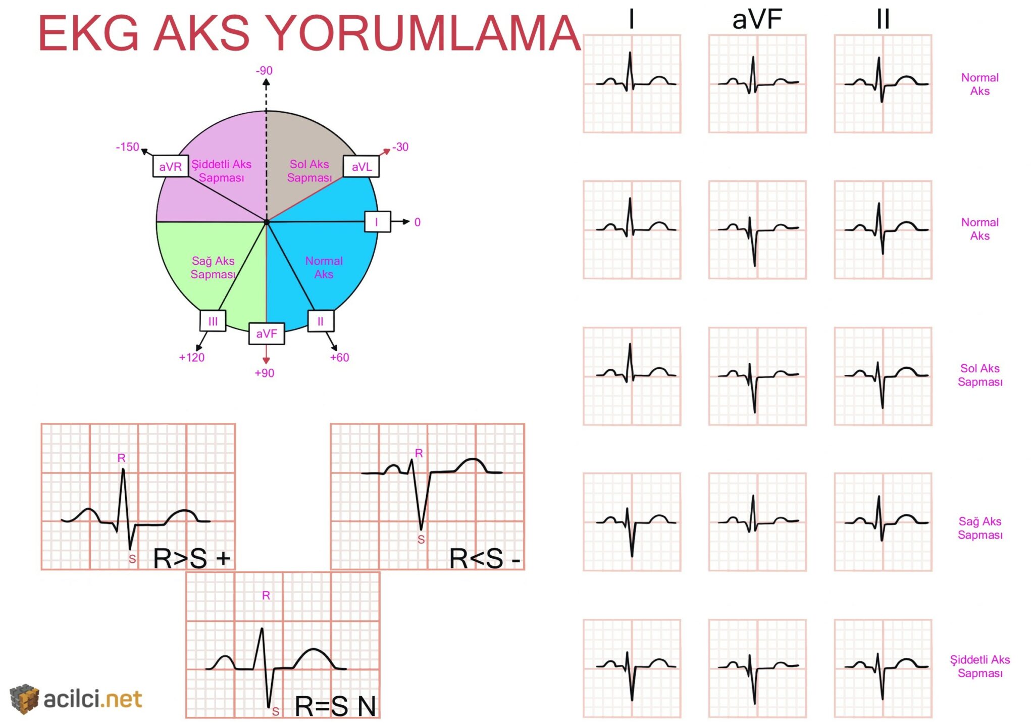 EKG Akıl Kartları – 1 - Acilci.Net