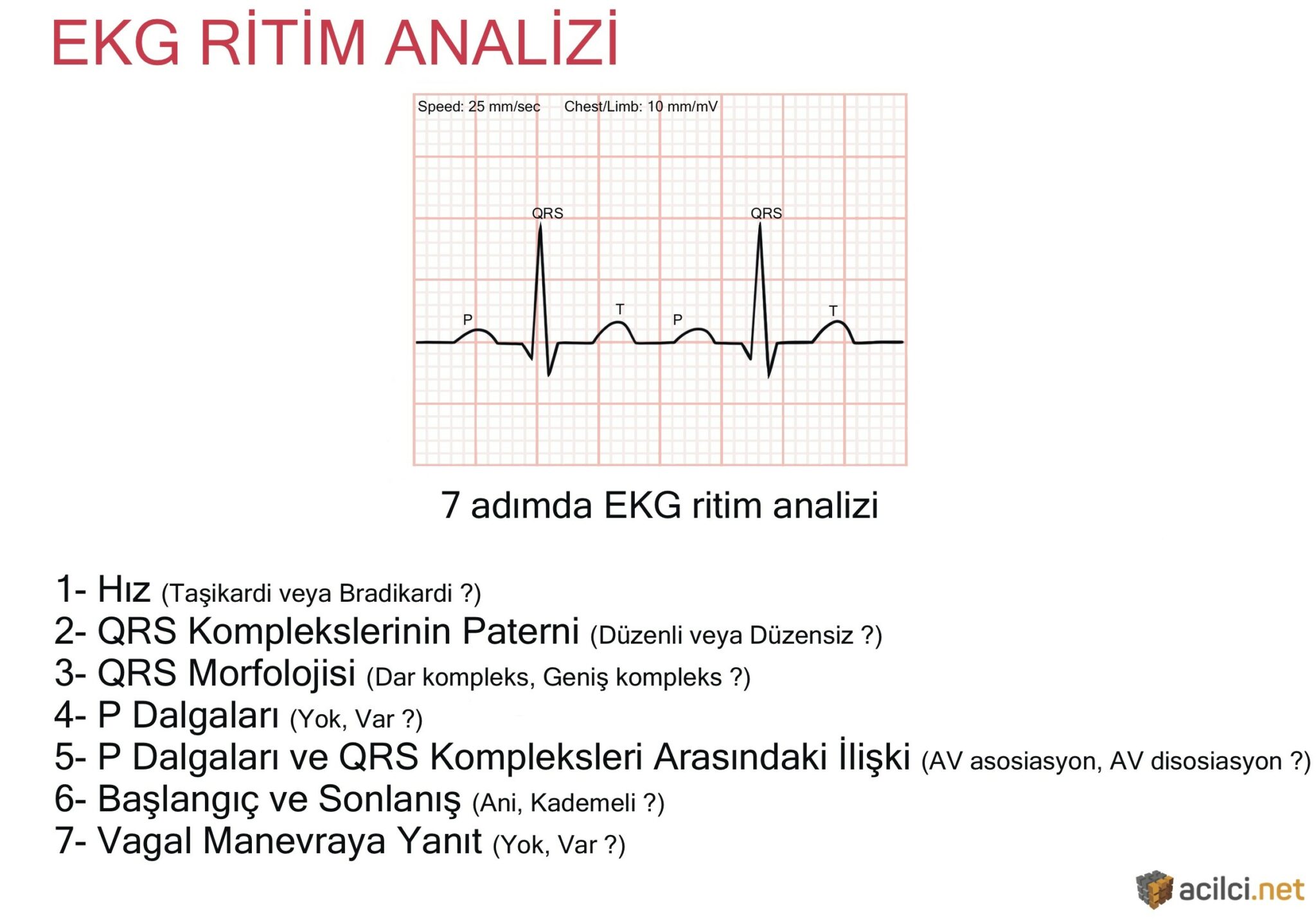 EKG Akıl Kartları – 1 - Acilci.Net
